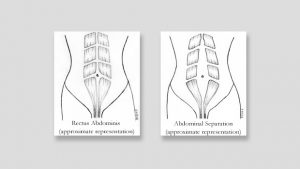 ABDOMINAL SEPARATION – PART 2 – Tammy Potter